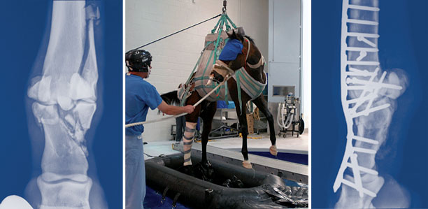 Kimzey aluminum splint