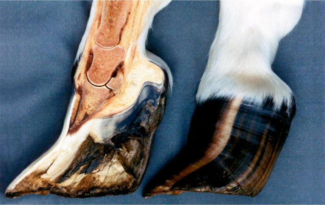 Dealing with a "Stump Foot"