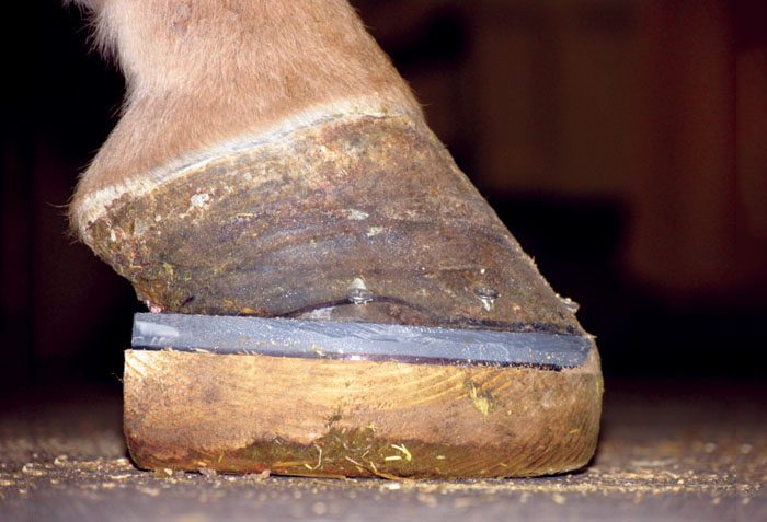 Shoe Support Is Critical With Half-Limb Casts