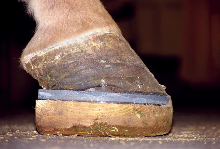 Shoe Support Is Critical With Half-Limb Casts