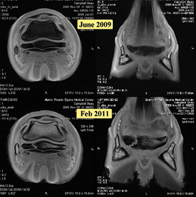 Using An Evidence-Based Treatment In A Fractured Navicular Bone Case ...