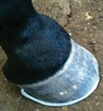 Recognize Improper Shoe Fit And Size | 2015-01-01 | ePublishing