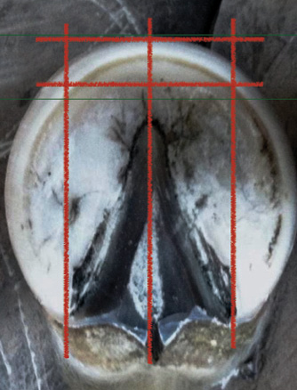 Recognize Improper Shoe Fit And Size | 2015-01-01 | ePublishing