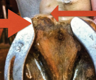 Recognize Improper Shoe Fit And Size | 2015-01-01 | ePublishing