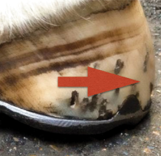 Recognize Improper Shoe Fit And Size | 2015-01-01 | ePublishing