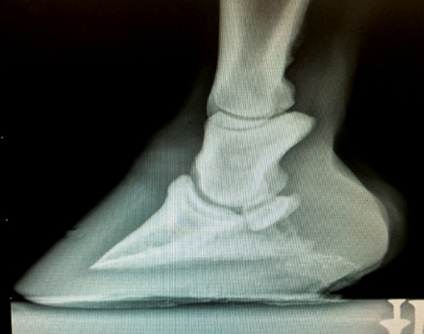 The Ideal Hoof Angle Depends On The Horse