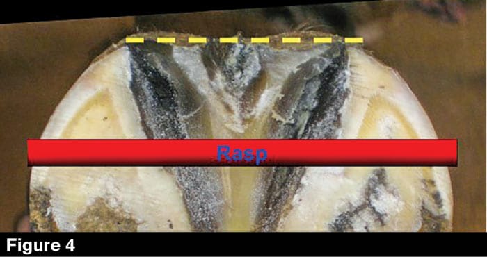 How To Identify And Treat Thrush