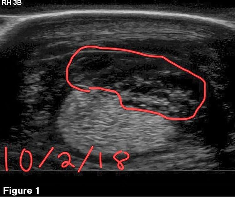 Severe Equine Tendon Injuries Don’t Have to be Fatal