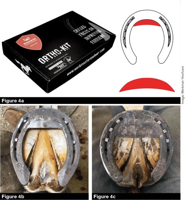 Suspensory