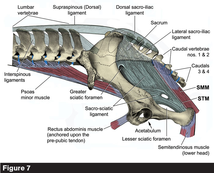 Lumbar Sacral Ligament