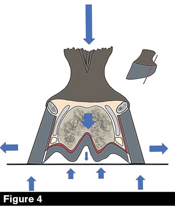 Applying the Heart-Bar Horseshoe