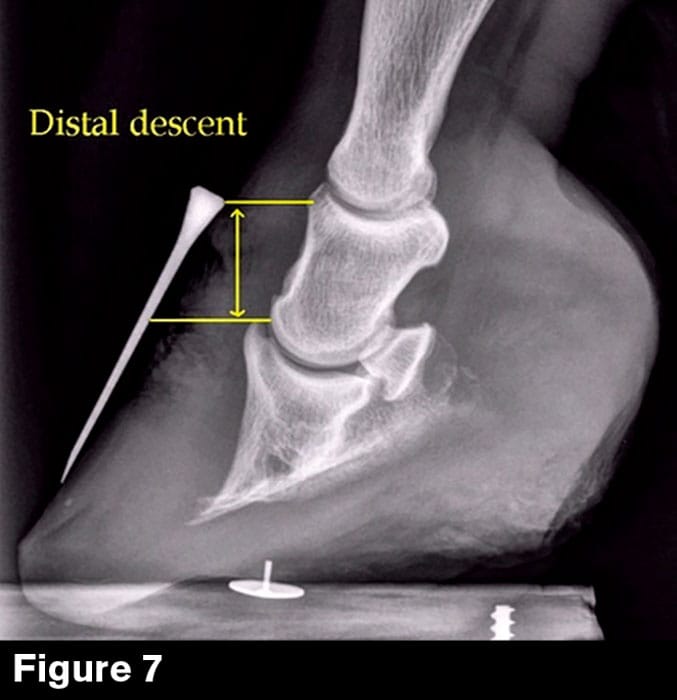 Applying the Heart-Bar Horseshoe