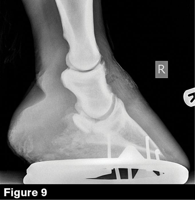 Applying the Heart-Bar Horseshoe