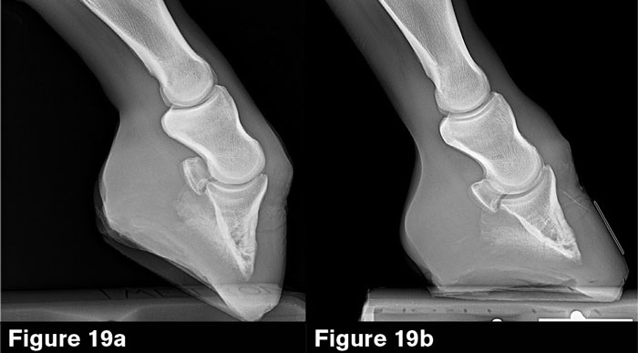 Managing Clubfoot in Foals
