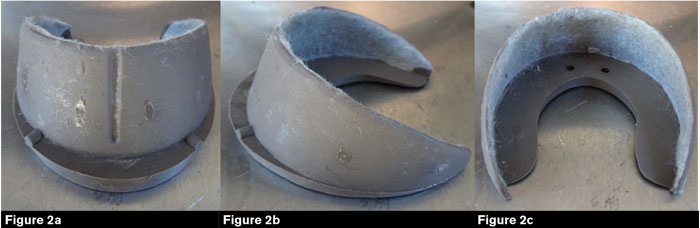 Managing Clubfoot in Foals