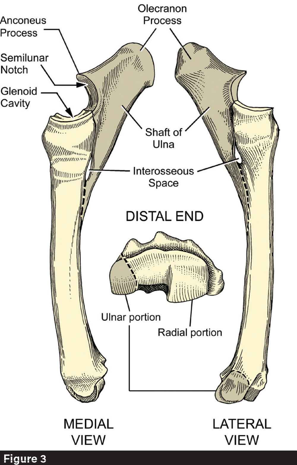 How Straightness Affects the Equine Hoof