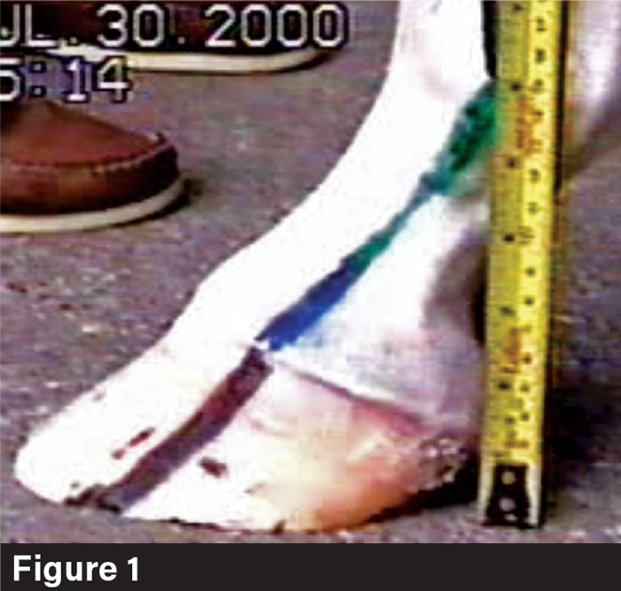 When Should the Equine Hoof & Pastern Angle Line Up?