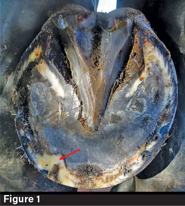 What is a Keratoma & How to Identify It